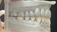 China Metal-Free Full Zirconia Dental Bridge with High Strength and Natural Appearance for Custom Zirconia Dental Bridge Restorations for sale