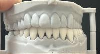 China Metal-Free Full Zirconia Dental Bridge with High Strength and Natural Appearance for Custom Zirconia Dental Bridge Restorations for sale