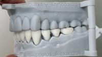 China Metal-Free Full Zirconia Dental Bridge with High Strength and Natural Appearance for Custom Zirconia Dental Bridge Restorations for sale