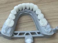 China Metal-Free Full Zirconia Dental Bridge with High Strength and Natural Appearance for Custom Zirconia Dental Bridge Restorations for sale