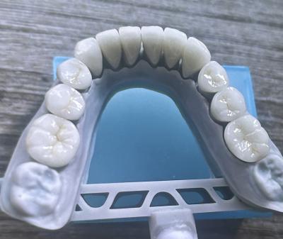 China Metal-Free Full Zirconia Dental Bridge with High Strength and Natural Appearance for Custom Zirconia Dental Bridge Restorations for sale