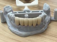 China Metal Framework Porcelain Aesthetics Functional Durability Porcelain-Fused-to-Metal Crown and PFM Dental Restoration for sale
