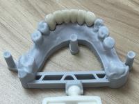 China Metal Framework Porcelain Aesthetics Functional Durability Porcelain-Fused-to-Metal Crown and PFM Dental Restoration for sale