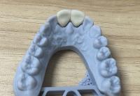China Customized Zirconia Dental Restorations with CAD/CAM Digital Design and Natural Translucency Aesthetic Finish for Zirconia Crowns and Bridges for sale