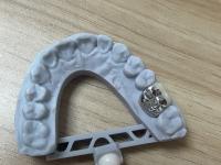 China Cobalt-Chromium PFM Crown and Porcelain-Fused-to-Metal Crown with Natural-Looking Porcelain Surface and Customized Design for sale