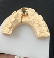 China Custom Gold Crown with Personalized Tooth Design and Customized Gold Appearance for Marginal Fit Inspection for sale