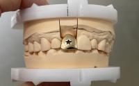 China Custom Gold Crown with Personalized Tooth Design and Customized Gold Appearance for Marginal Fit Inspection for sale