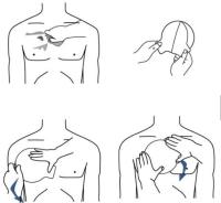 China Medical Chest Seal Vented Rescue Chest Dressing Bandage Occlusive Patch Occlusive Thoracic for sale