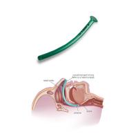 China Disposable Nasal Nasopharyngeal Airway 7MM For First-Aid Emergency Medical Consumables for sale