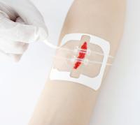 China Disposable Emergency wound Closure strips,Pu film strips Can Close The 3cm WoundZip Stitch Wound Closures Device for sale
