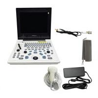 China K5 Ultrasound Scanner (Standard Convex Probe) for sale