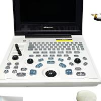 China K5 Ultrasound Scanner (Standard Convex Probe) for sale