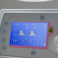 China JOGGER Digital Transport Ventilator With 8H Backup Battery 5 Alarm System Oxygen Concentration Monitoring Emergency Rescue for sale