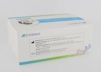 China TUV Quantitative Covid 19 Rapid Test Kit 5 Or 25 Or 50 Pcs/Box for sale