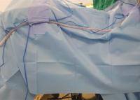 China Spine Surgery Disposable Surgical Drapes With Liquid Collection Pouch And Insice Film for sale