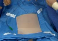 China Surgical Laparoscopy Drape , Sterile Disposable Patient Drapes With ETO Blue Color for sale