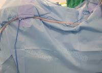 China Sterile Surgical Spine Drape Pack With Liquid Collection Pouch,Tube holders,Oblong fenestration for sale