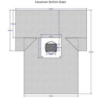 China Absorbent Reinforced 40g - 60g SP / SMS / SMMS / SMMMS C-Section Surgical Drape For Caesarean Section With Collection for sale