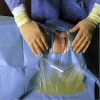 China 100% Polypropylene Sterilized Disposable Surgical Drape For Ophthalmology for sale