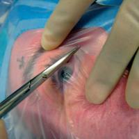 China Ophthalmic Formable Molder Disposable Sterile Surgical Drapes With Cable Holder for sale
