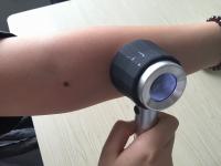 China Customized Health Care Handheld Medical Dermatoscope for Skin Inspection for sale