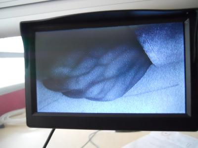 China Portable Vein Finder Machine Better Penetration For Hospital Vein Locator for sale