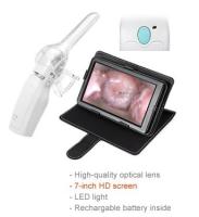 China Digital Endoscope Self-Inspect Colposcope for sale