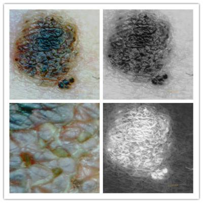 China Skin Inspector Digital Microscope Skin Analyzer Skin and Scalp Camera  With Resolution of 5M Pixels for sale