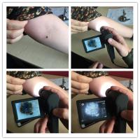 China Digital Dermatoscope Skin And Hair Inspection Microscope With 3 Inch LCD Screen Rotated 360° for sale