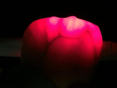 China Transilluminator Vein Locator Infrared Vein Finder Safty LED Red Light for sale