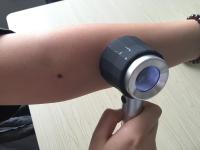 China High Accuracy Optical Magnifier 10 Times Dermatoscope Skin Analyer Using 2 *  AA No.5 Batteries Metal Optical Glass Lens for sale