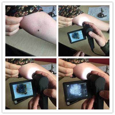 China Professional Electronic Video Dermatoscope Skin Inspecter With Micro SD Card for sale