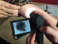 China Professional Electronic Video Dermatoscope Skin Inspecter With Micro SD Card for sale