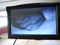 China Vascular Images Displaying Veins In Screen Infrared Vein Finder For Nurses And Doctors for sale