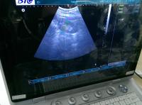 China 3D Digital B / W Portable Ultrasound Scanner With Convex Linear Transvaginal Probes for sale