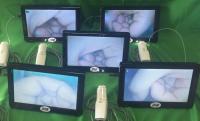 China Digital Video Colposcope for Woman Care 10 or 7 Inch Medical Monitor Professional Camera for Inspection of Cervix for sale