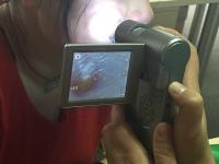 China 3 Inches TFT LCD Video Dermatoscope with Lithium 3.7V / 1050mAh Rechargeable Battery for Hair and Skin Inspection for sale