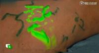 China High Contrast Image Vein Light Vein Locator Device For Medical Puncture by Projection for sale