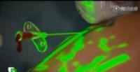 China High Contrast Image Vein Light Vein Locator Device For Medical Puncture by Projection for sale
