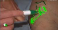 China High Contrast Image Vein Light Vein Locator Device For Medical Puncture by Projection for sale