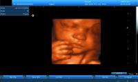 China 3D Digital Laptop Portable Ultrasound Scanner With All Kinds of Probe for sale