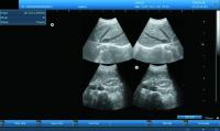China 3D Digital Laptop Portable Ultrasound Scanner With All Kinds of Probe for sale