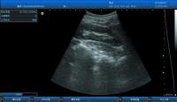 China 3D Digital Laptop Portable Ultrasound Scanner With All Kinds of Probe for sale