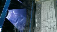 China PC Based B / W Portable Ultrasound Scanner 15 inch Laptop Screen Only 5kgs Weight Convenient to Carry for sale