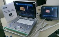 China Popular 3D Digital Laptop Veterinary Ultrasound Scanner Lightweight Easy To Carry for sale