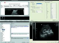China Popular 3D Digital Laptop Veterinary Ultrasound Scanner Lightweight Easy To Carry for sale