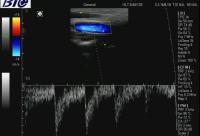 China 3D Laptop Ultrasound Scanner Color Doppler Machine With Large Volume Hardisk for sale