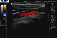China 3D Laptop Ultrasound Scanner Color Doppler Machine With Large Volume Hardisk for sale