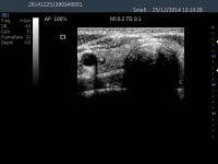 China 15 Inch LCD Screen 2D Colour Doppler Machine Test Digital With Wide Angle Imaging for sale