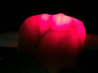 China Handheld Pocket Vein Light Infrared Vein Finder Vein Viewing System Easy to hold for sale